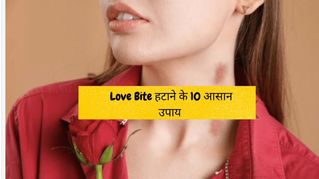 Love Bite कैसे हटाएं? 10 घरेलू उपाय